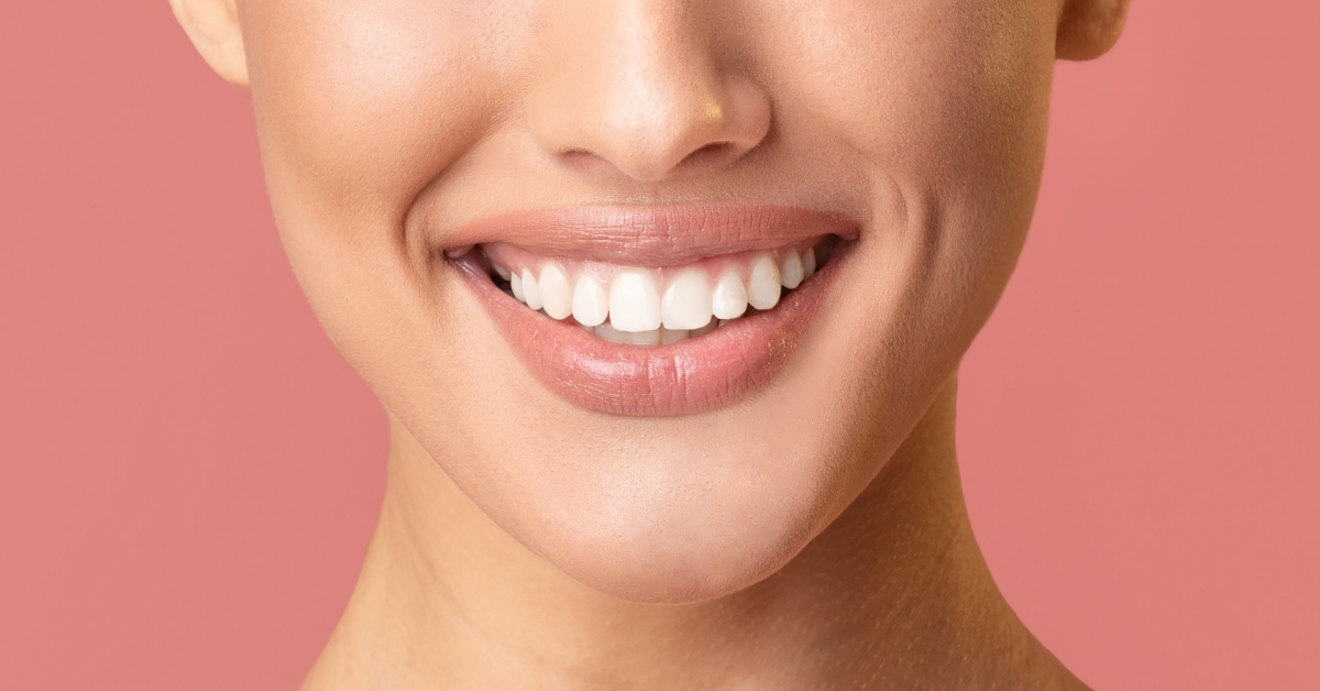 4 Benefits of Teeth Whitening | Rocky Mountain Smiles