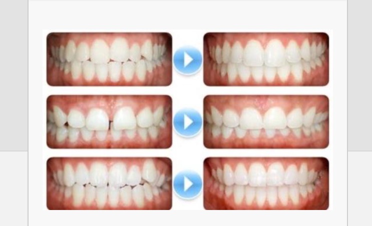 Before & After Gallery | Ortho One